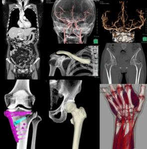 GEヘルスケア社製 64列CT【Revolution Maxima】 | 病院情報 | 所沢中央病院